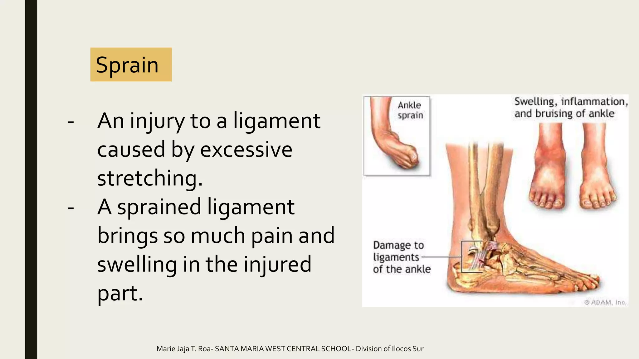 Common Bone and Muscle Injuries | PPTX