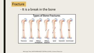 Common Bone and Muscle Injuries | PPTX