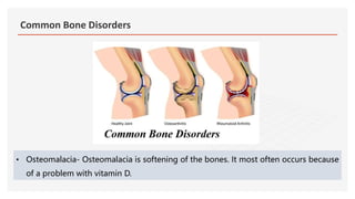 Common Bone Disorders | PPTX | Bone and Joint Conditions | Diseases and ...