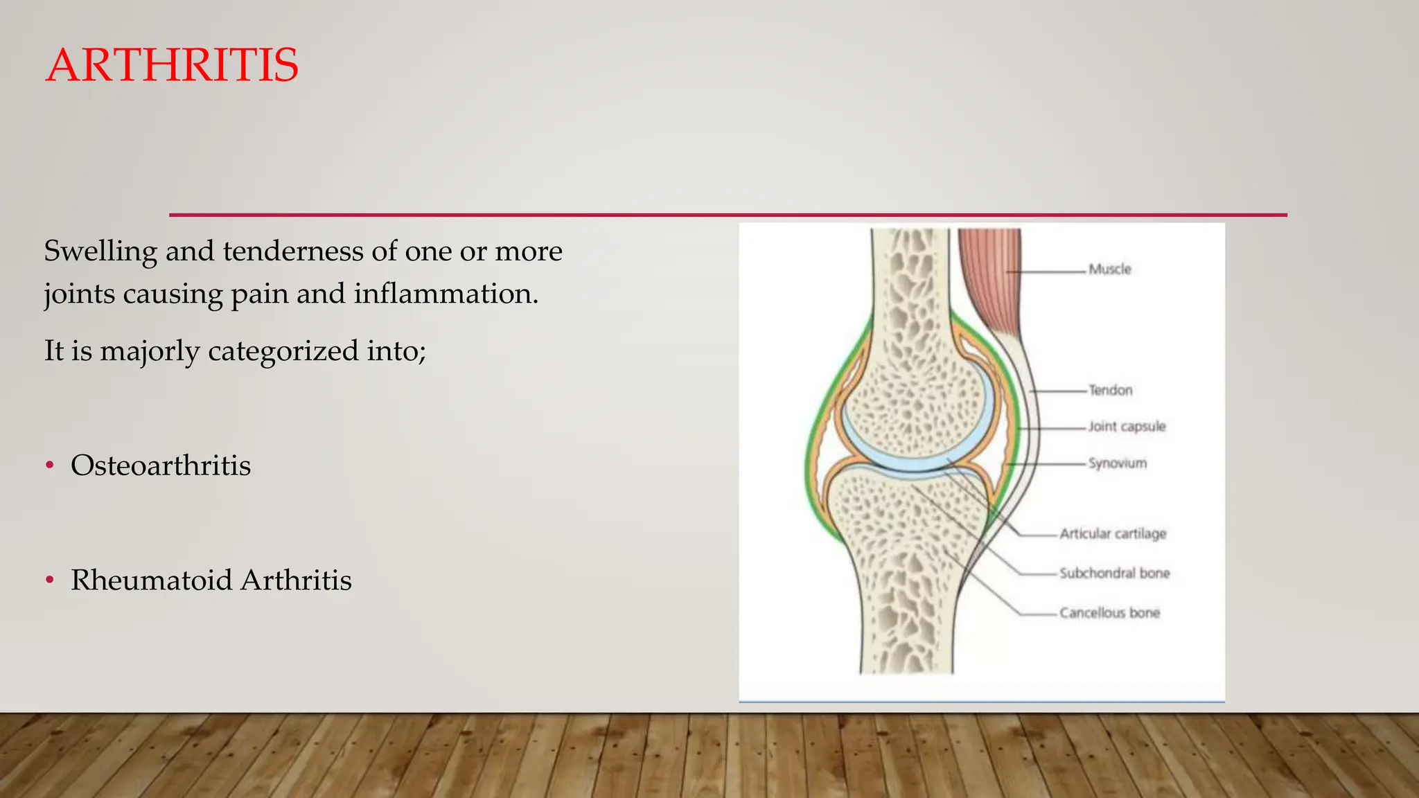 Common Bone Pathologies esp arthrit.pptx | Bone and Joint Conditions ...