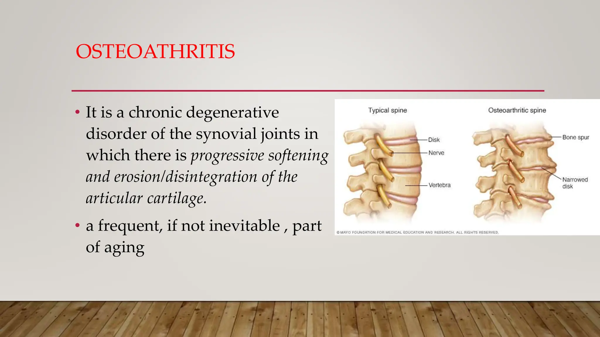 Common Bone Pathologies esp arthrit.pptx | Bone and Joint Conditions ...