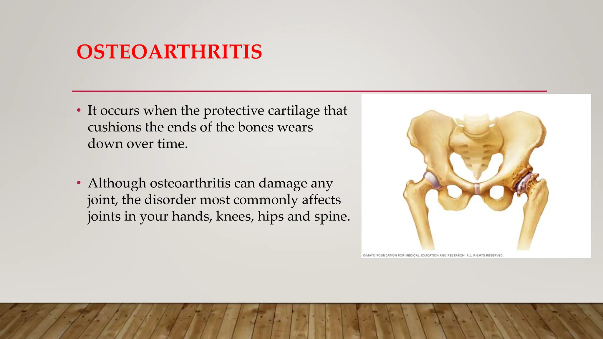 Common Bone Pathologies esp arthrit.pptx | Bone and Joint Conditions | Diseases and Conditions