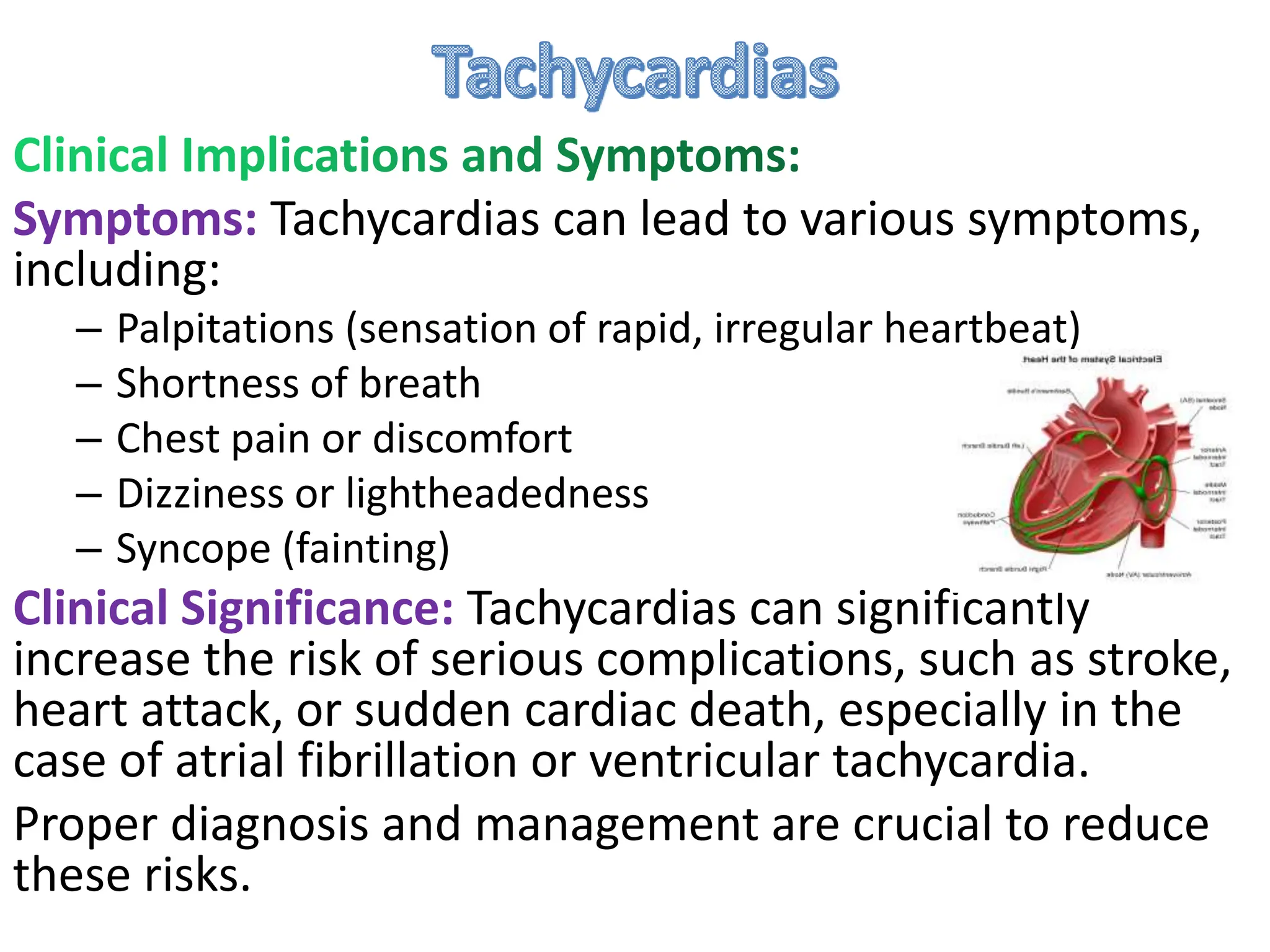 common cardiac arrhythmias.ppsx
