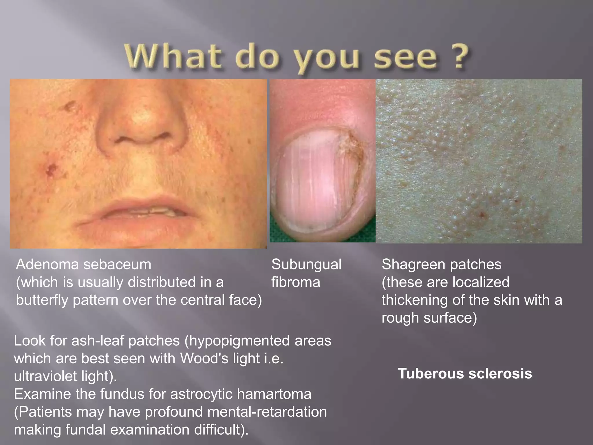 Common Cases: Skin conditions and the Eye | PPTX