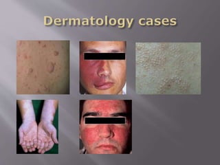 Common Cases: Skin conditions and the Eye | PPTX