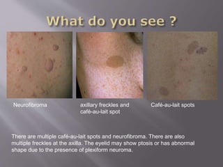 Common Cases: Skin conditions and the Eye | PPT