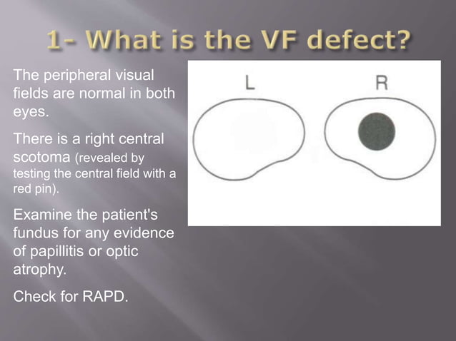 Common Cases: Neurological Visual Field defects | PPTX