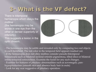 Common Cases: Neurological Visual Field defects | PPTX