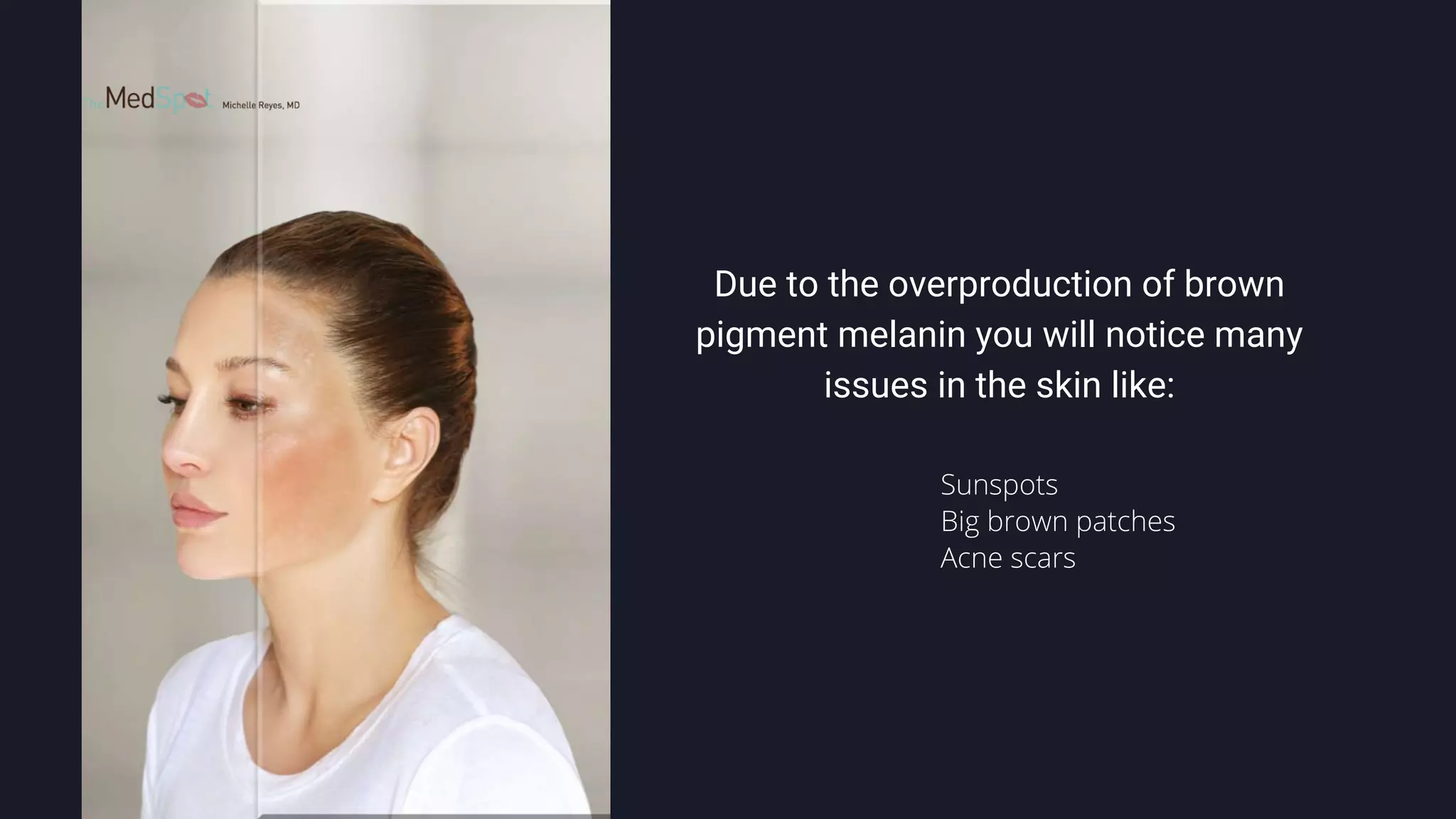 Common Causes Behind the Hyperpigmentation Issues in Skin | PPTX