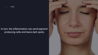 Common Causes Behind the Hyperpigmentation Issues in Skin | PPTX