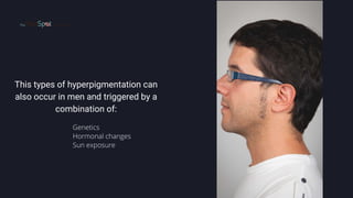 Common Causes Behind the Hyperpigmentation Issues in Skin | PPTX