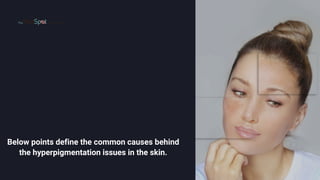 Common Causes Behind the Hyperpigmentation Issues in Skin | PPTX | Skin ...