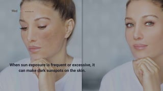 Common Causes Behind the Hyperpigmentation Issues in Skin | PPTX | Skin ...