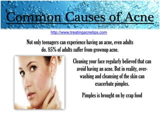 Common causes of acne | PDF | Skin and Dermatology | Diseases and ...