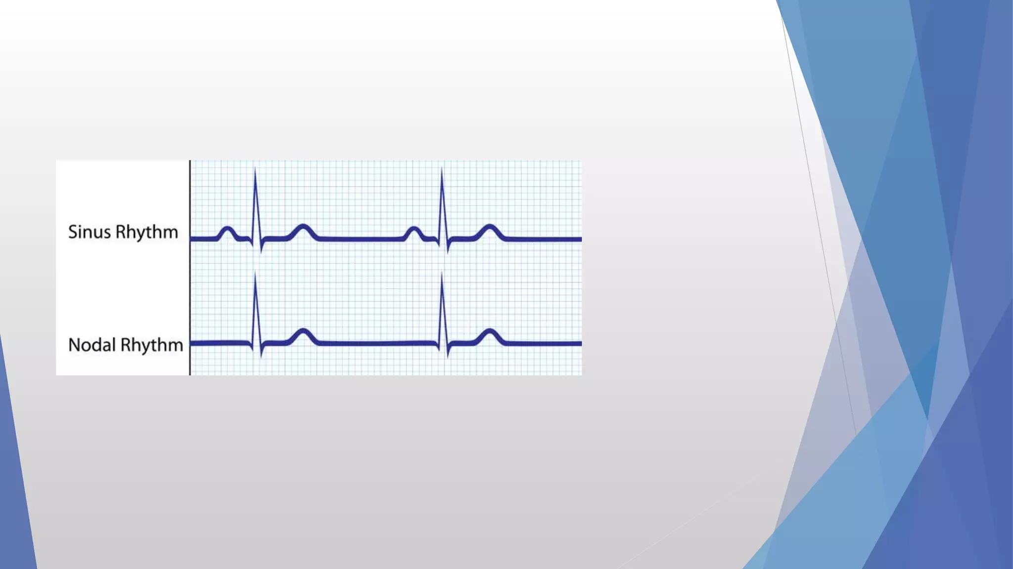 Common chest x rays and common ecgs | PPTX