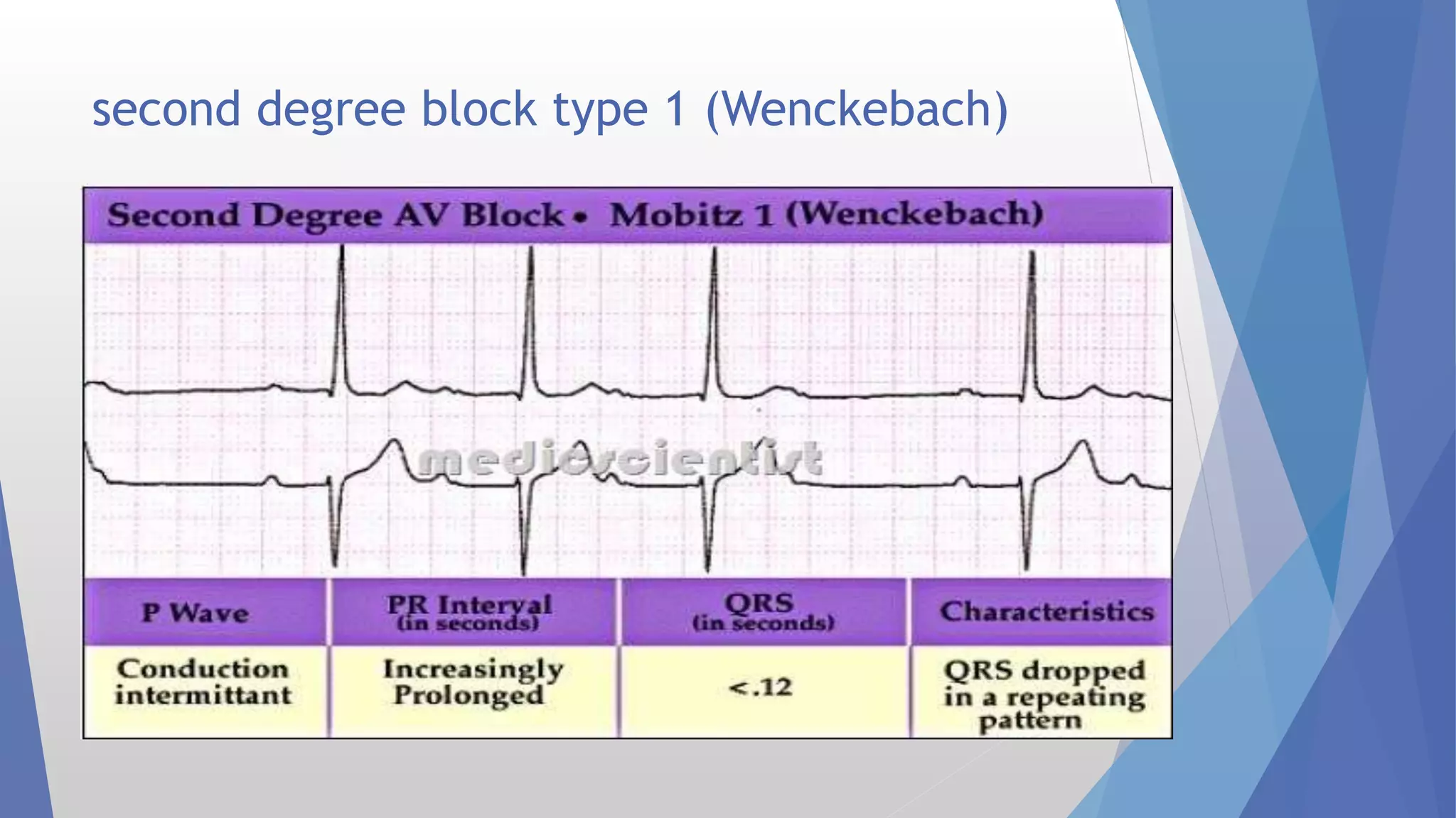 Common chest x rays and common ecgs | PPTX