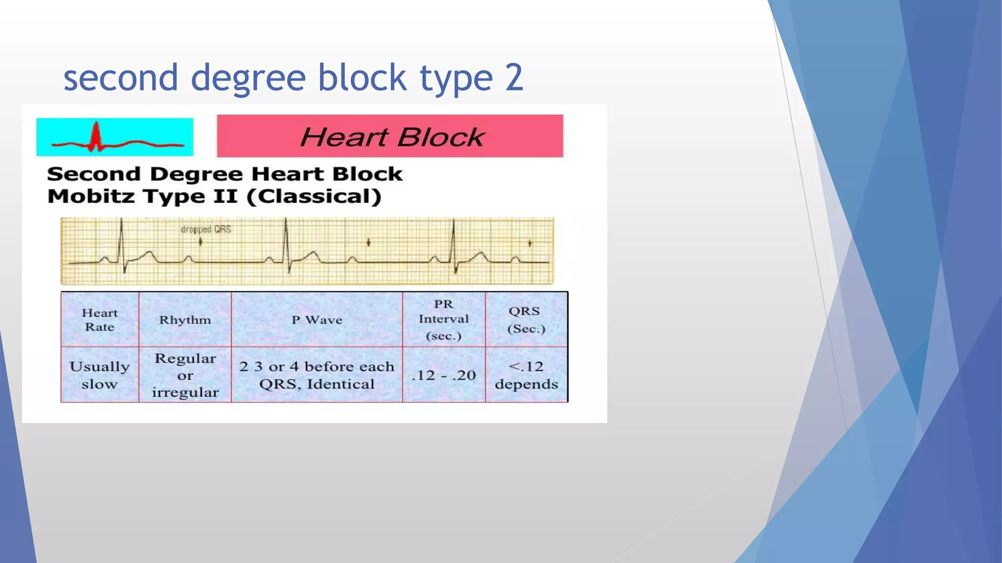 Common chest x rays and common ecgs | PPTX