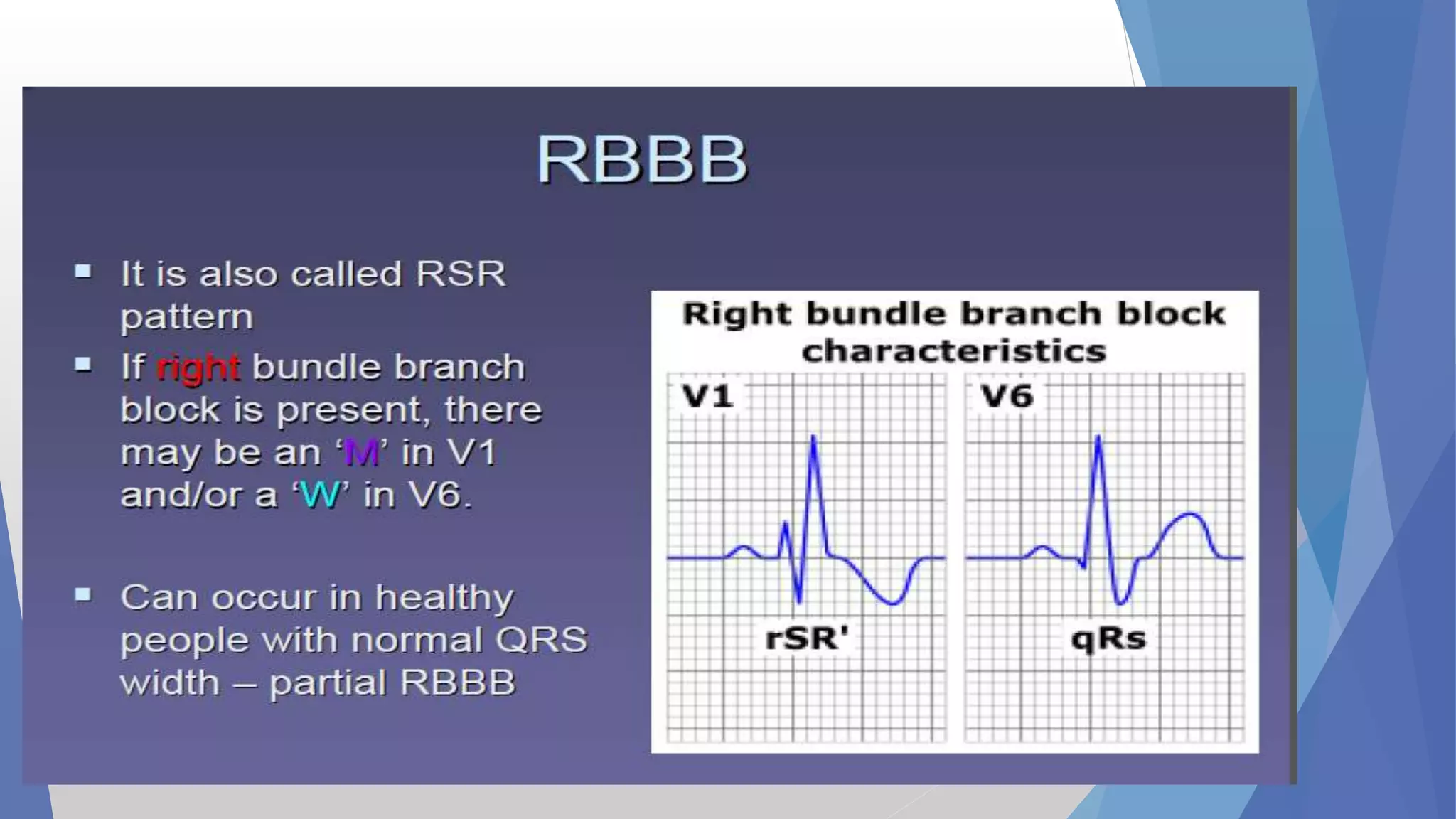 Common chest x rays and common ecgs | PPTX