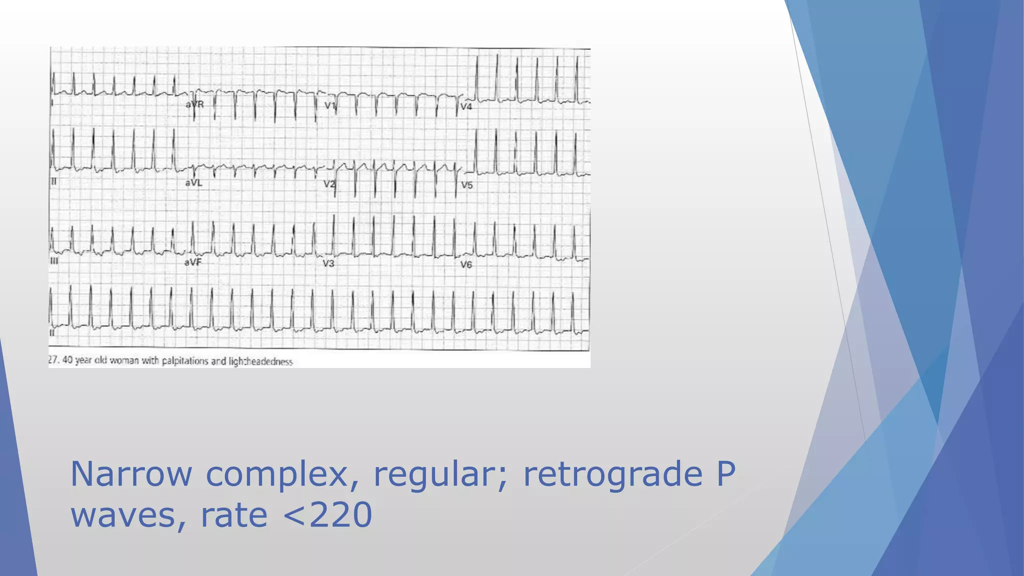 Common chest x rays and common ecgs | PPTX