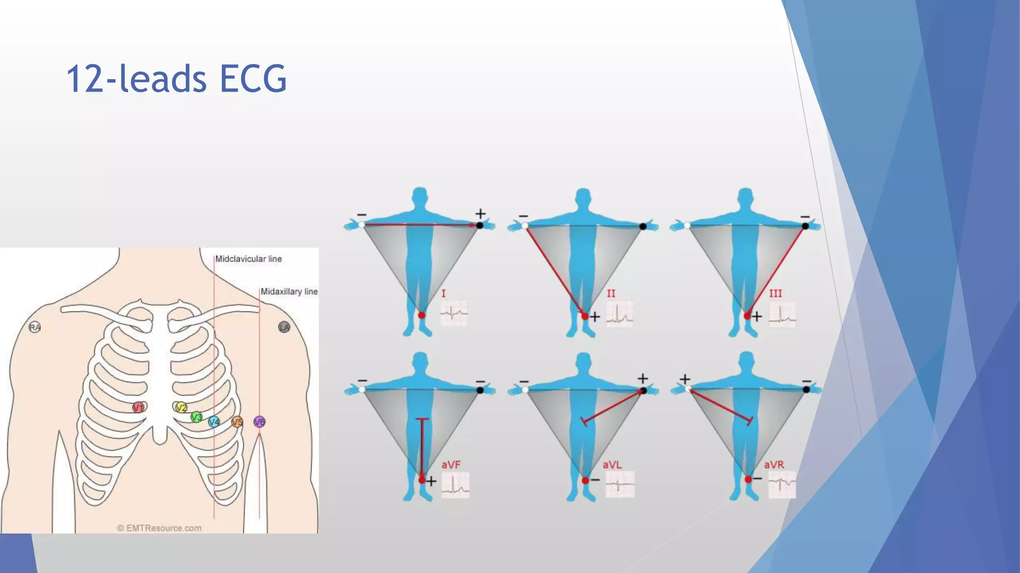 Common chest x rays and common ecgs | PPTX