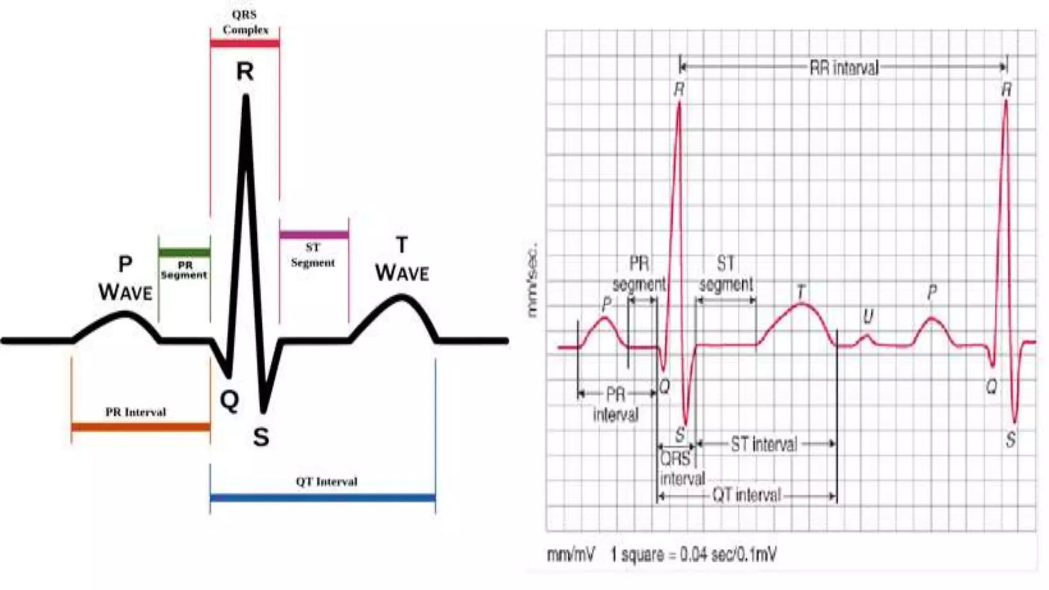 Common chest x rays and common ecgs | PPTX