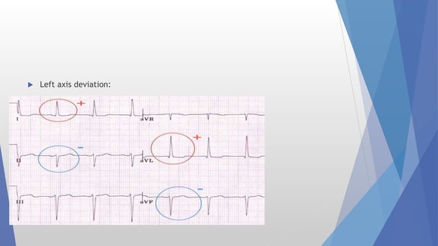 Common chest x rays and common ecgs | PPT
