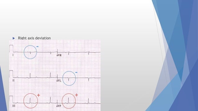 Common chest x rays and common ecgs | PPT