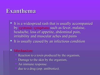 Common childhood exanthemas2 | PPT