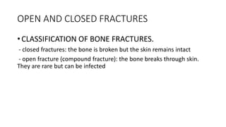 COMMON CHILDHOOD FRACTURES. .pptx