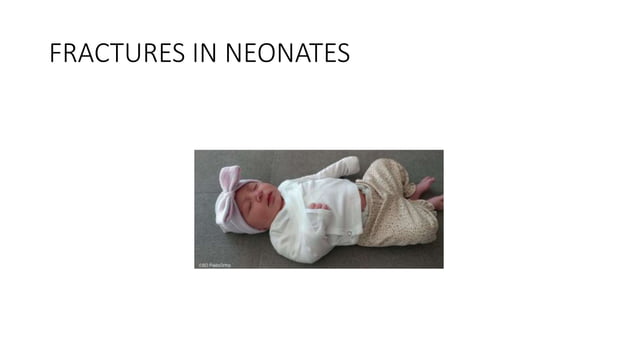 COMMON CHILDHOOD FRACTURES. .pptx