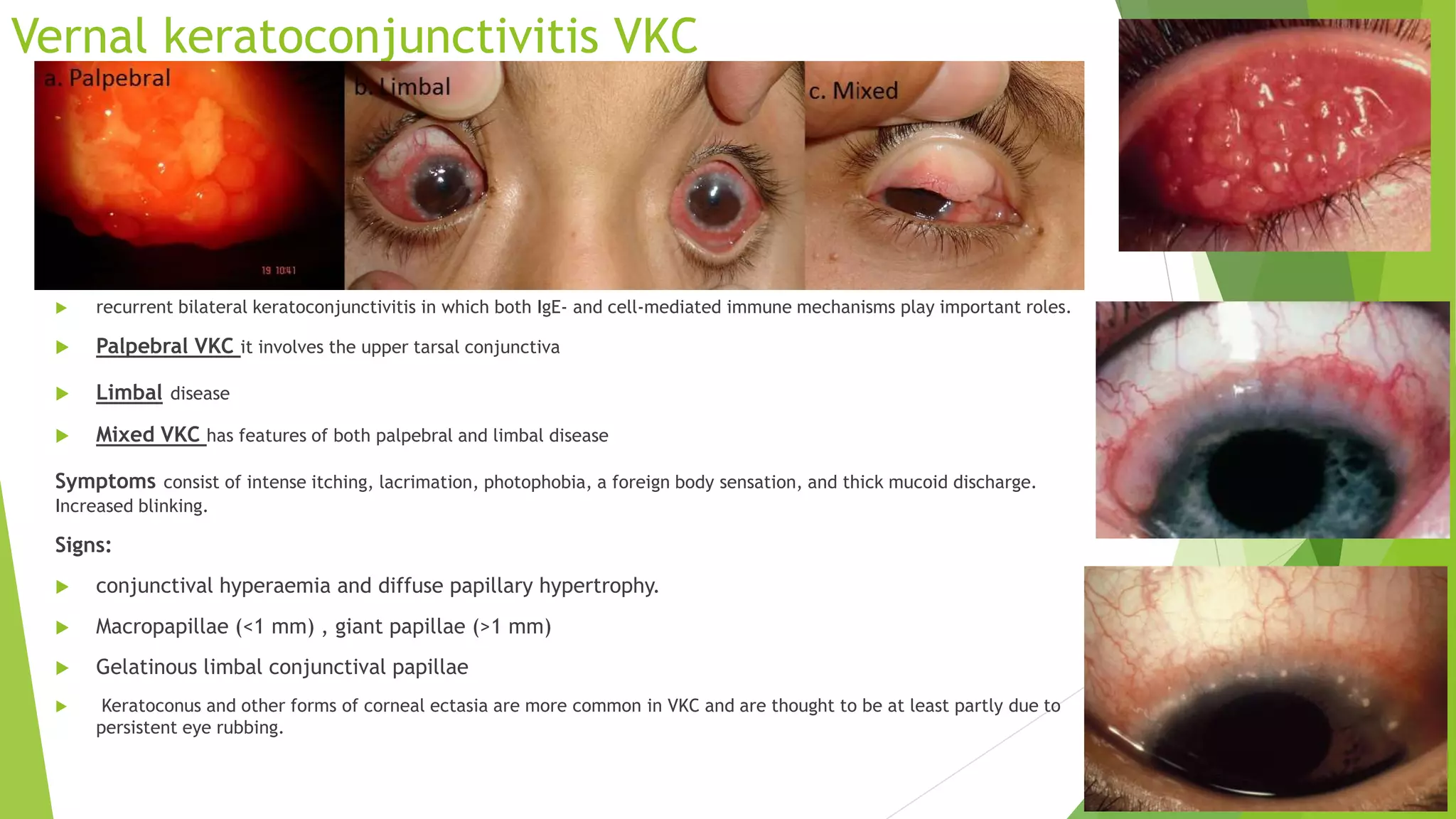 Common children eye disorders | PPTX