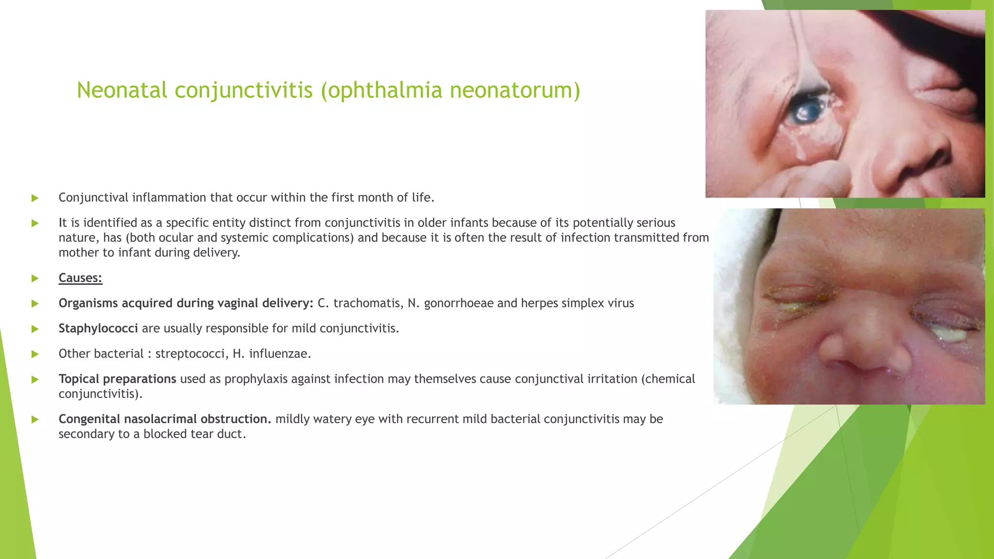 Common children eye disorders | PPTX