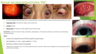 Common children eye disorders | PPTX