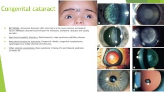 Common children eye disorders | PPTX