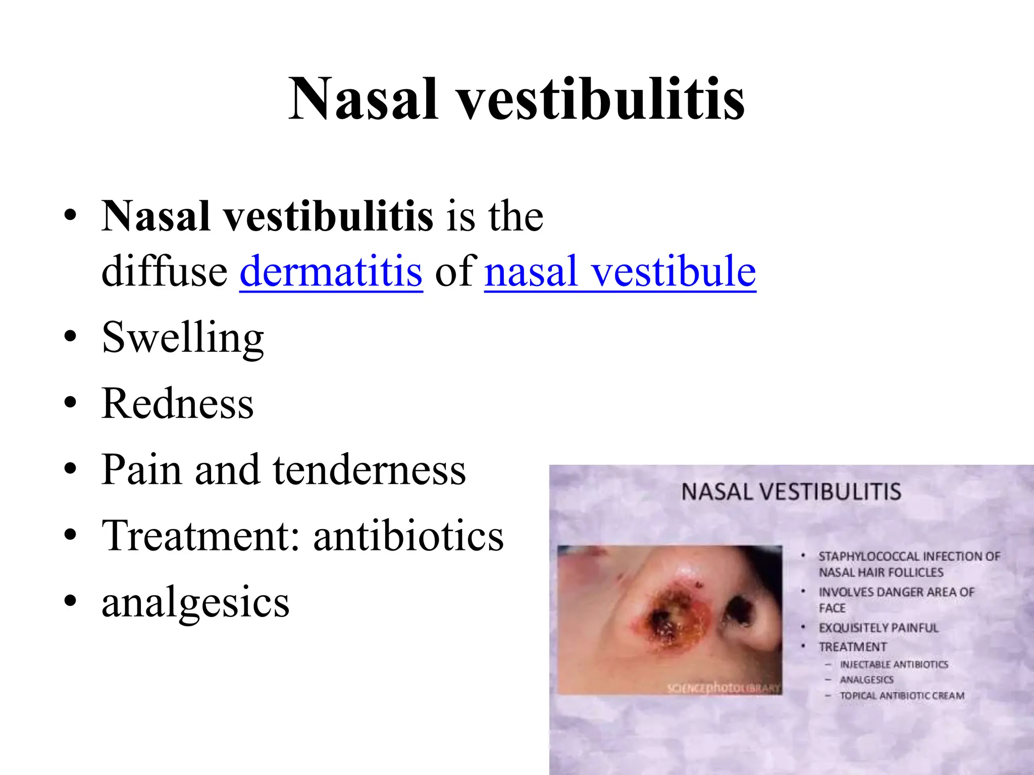 COMMON COMPLICATIONS OF DIABETES IN EAR,NOSE AND THROAT - Copy.pptx
