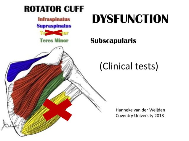 Full thickness rotator cuff tears, Value of clinical tests | PPT