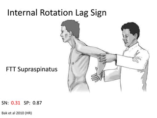 Full thickness rotator cuff tears, Value of clinical tests | PPTX
