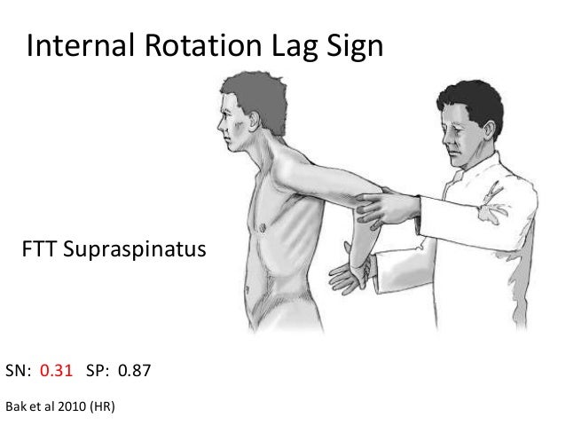 Full Thickness Rotator Cuff Tears Value Of Clinical Tests