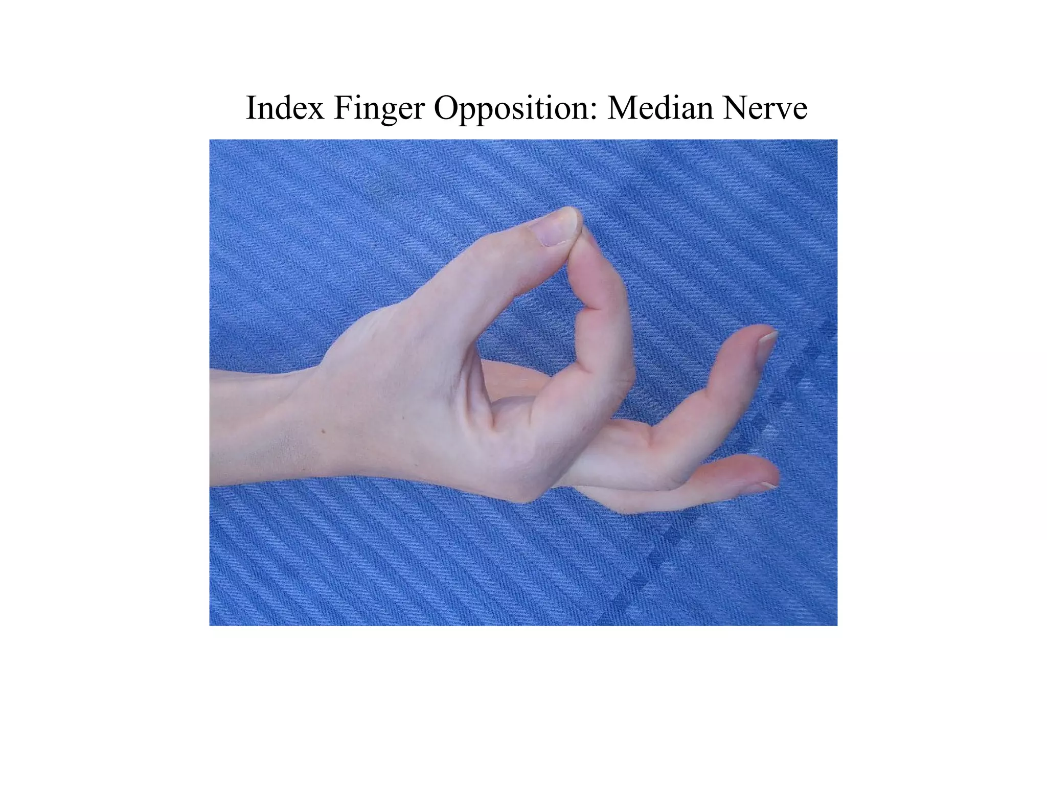 Common conditions of the hand (2013) | PPT