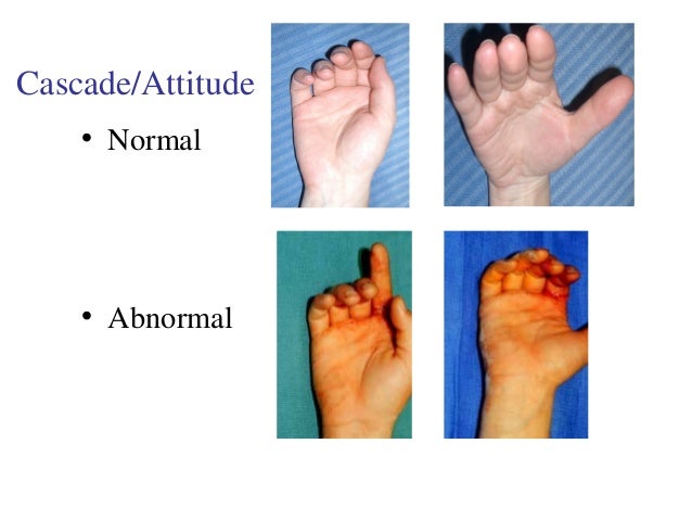 Common conditions of the hand (2013)