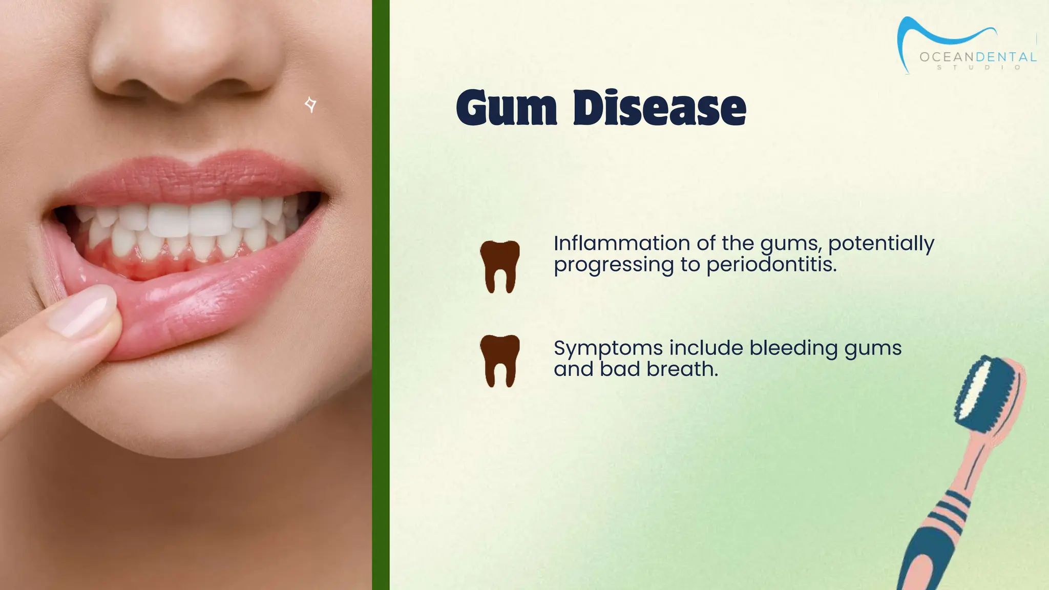 Five Common Dental Problems In Adults | A Quick Guide | PPTX
