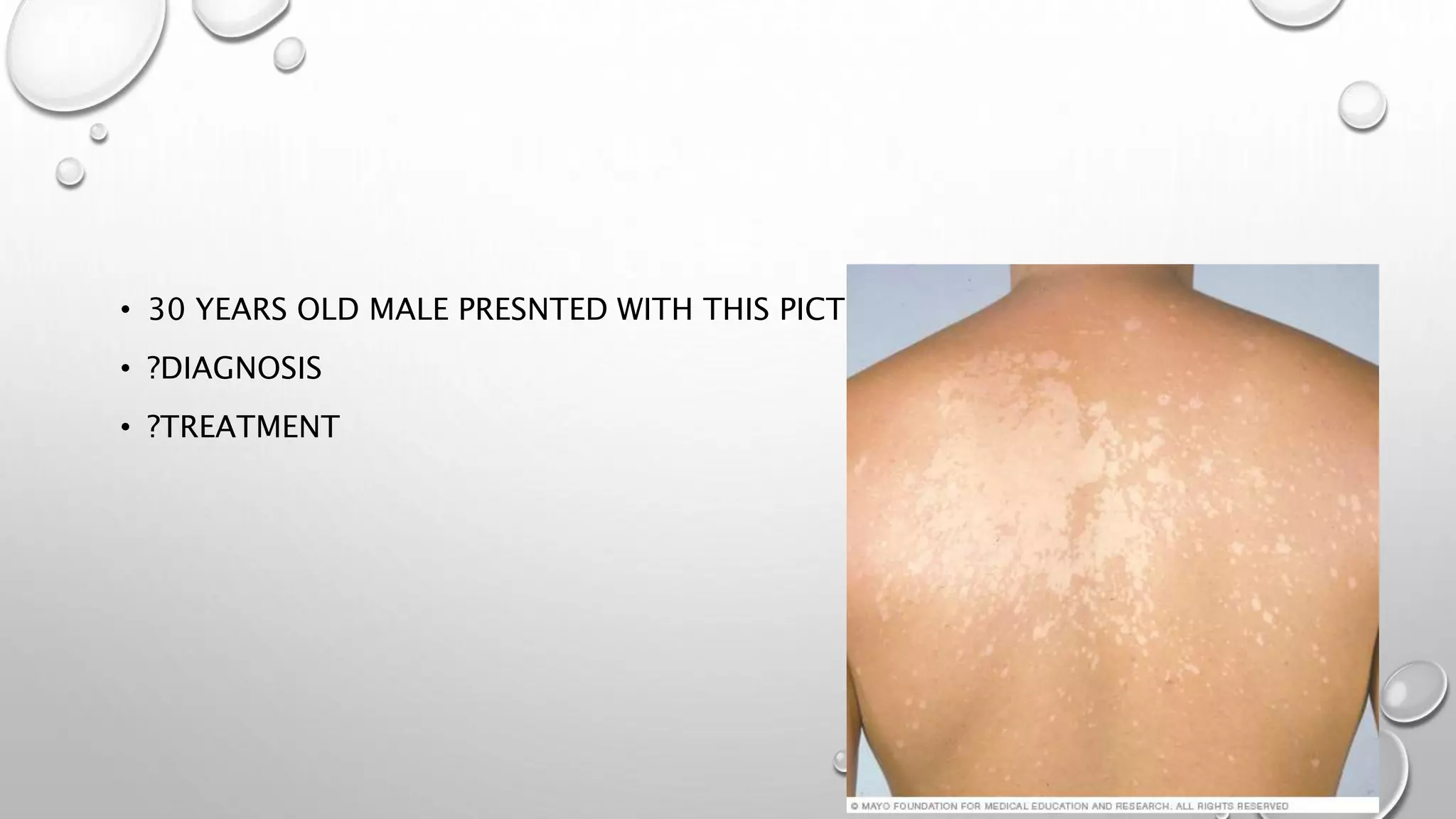 Common dermatological cases | PPTX