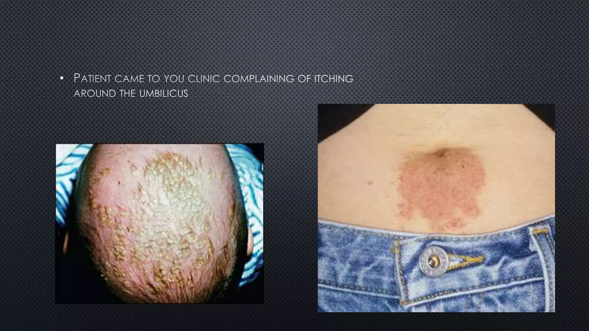 Common Dermatological Problems | PPSX