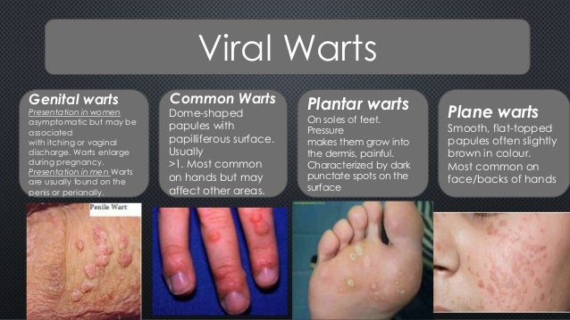 Common Dermatological Problems
