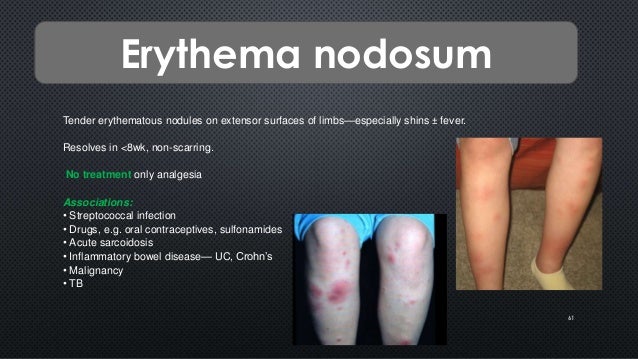 Common Dermatological Problems