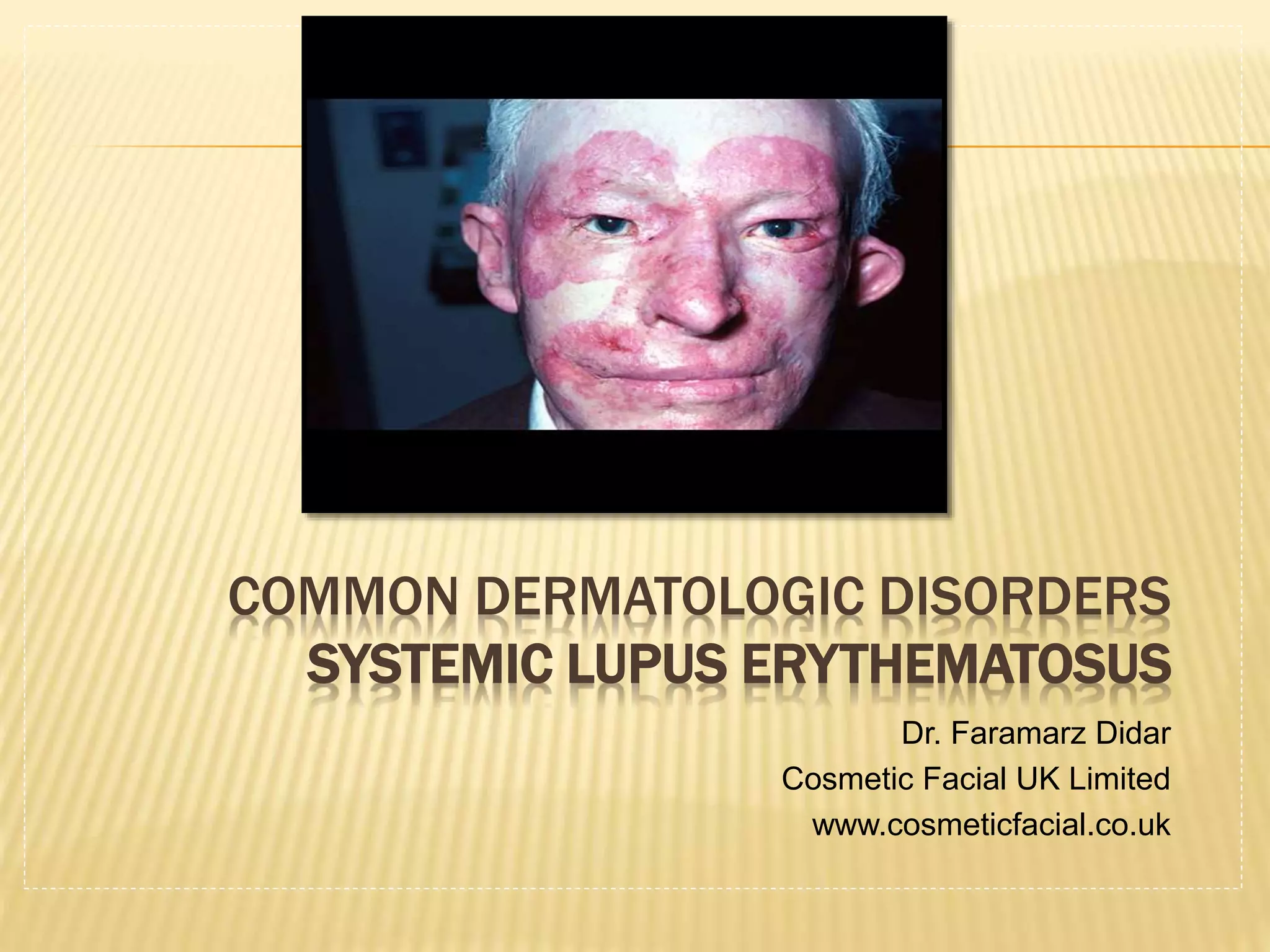 Common dermatologic disorders systemic lupus erythematosus | PPT