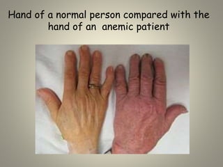 Common diseases | PPTX