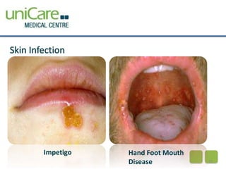 Common Diseases In School Children - Dr. Ismail | PPTX
