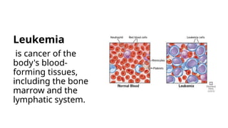 Common Diseases of the Circulatory System and Respiratory.pptx
