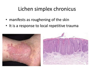 COMMON DISEASES OF THE SKIN.pptx